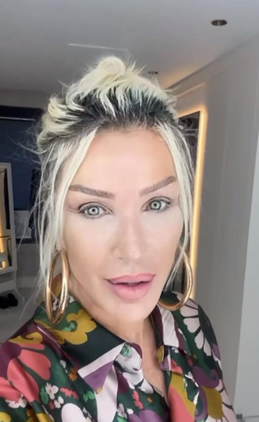 Seda Sayan estetiklerine bir yenisini daha ekledi - Haber3